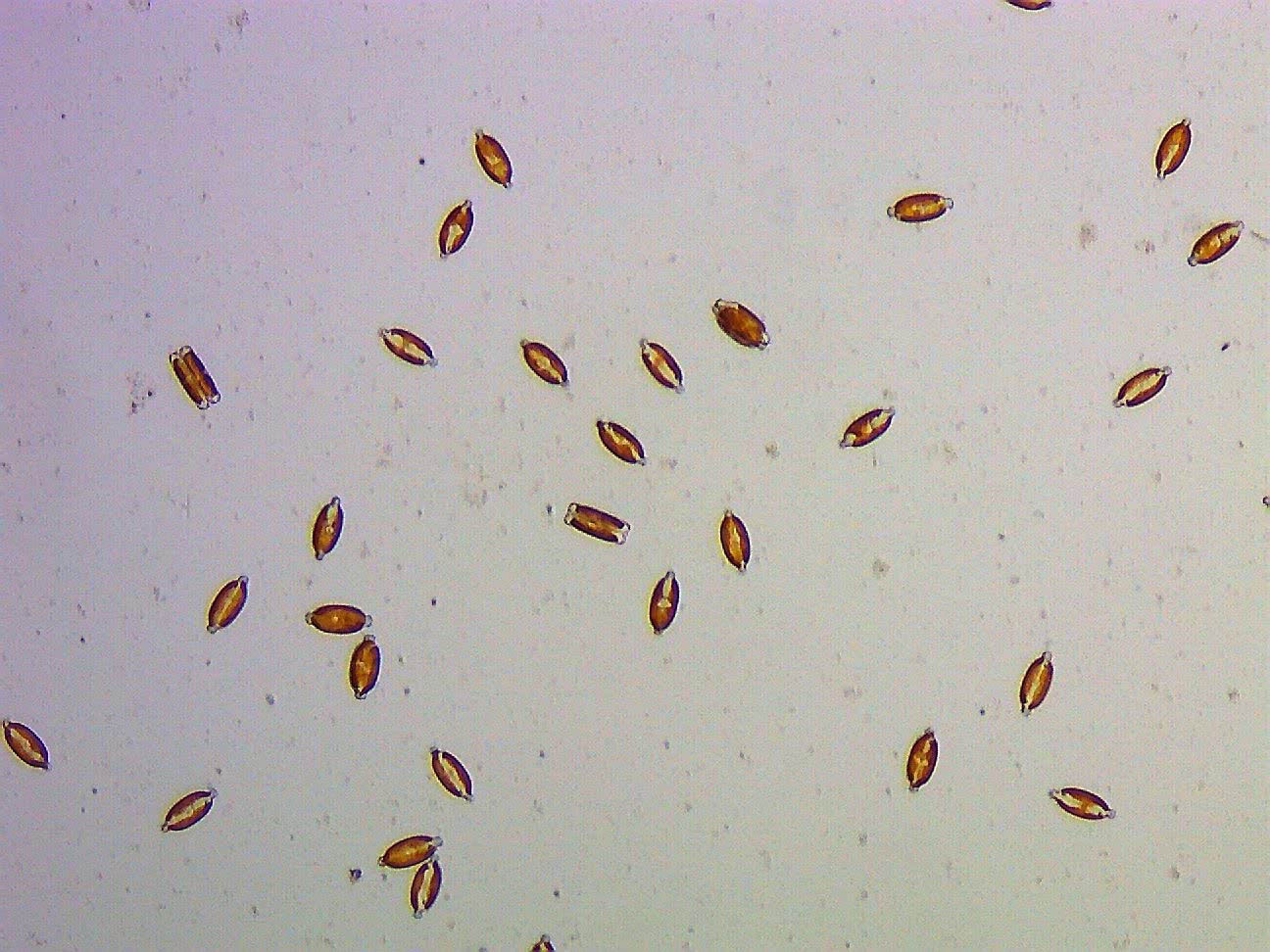 Diatoms Under Microscope 100x